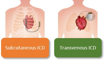 Device-related complications ICD - ERN GUARD-Heart